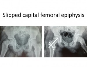 Paediatric Ophthalmology Results Gallery - Agashe Hospital