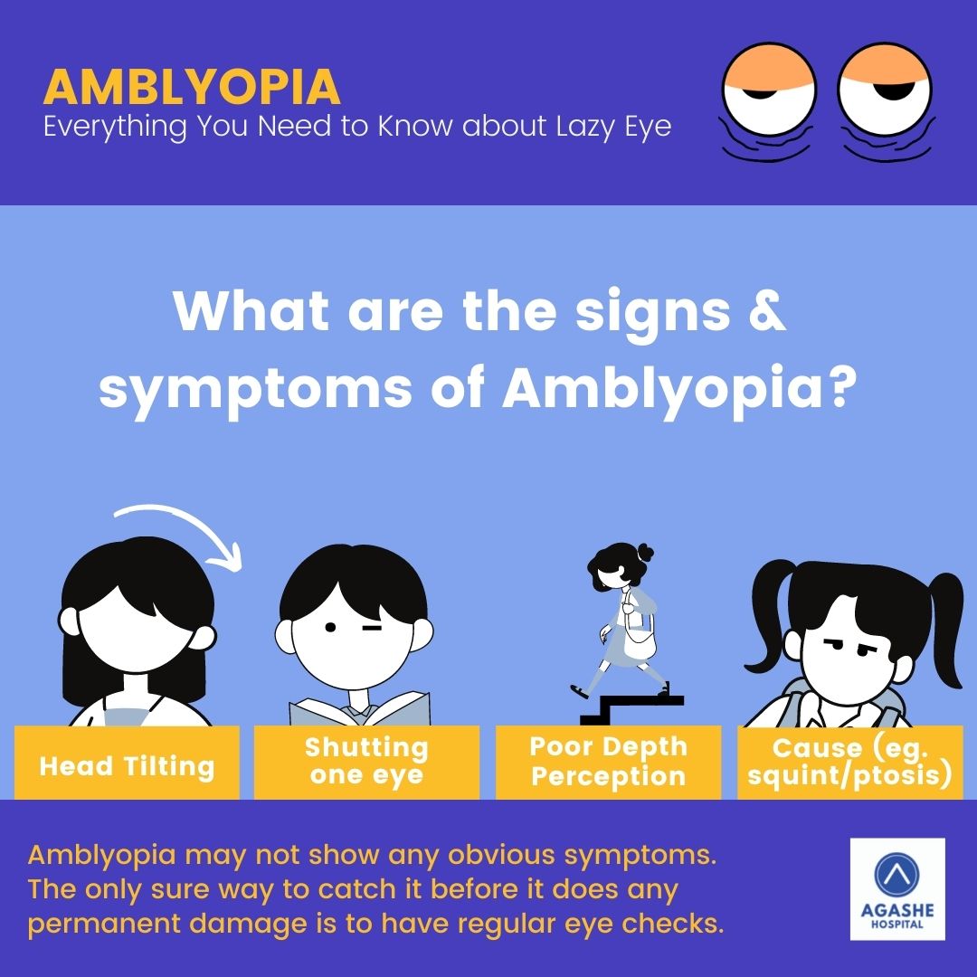 Amblyopia - Agashe Hospital